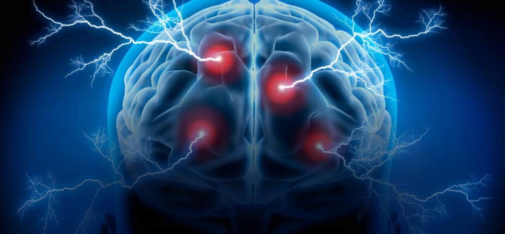 Stroke Types & Natural Remedies